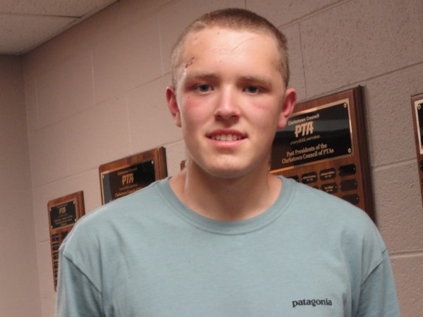 Josh Berg Makes First Public Appearance After Bear Attack - New City ...