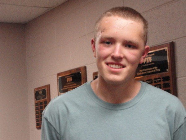 Josh Berg Makes First Public Appearance After Bear Attack - New City ...