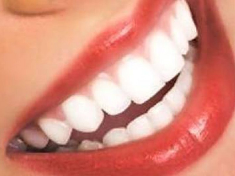 Dealing with Chipped, Broken and Bruised Teeth | Silver Spring, MD Patch